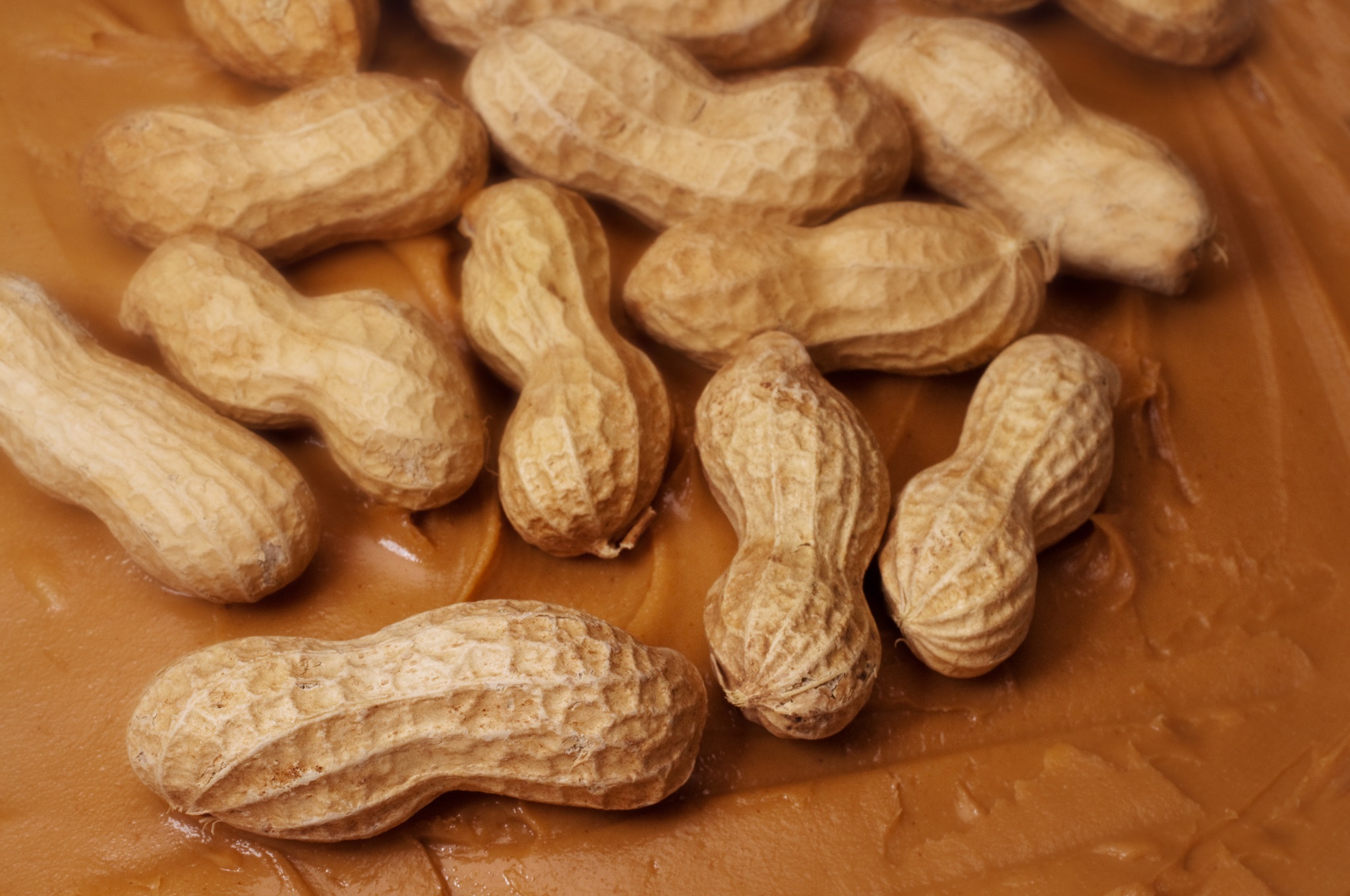 Updated Peanut Allergies Guidelines for Infants and Children