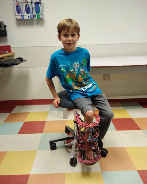 Limb Loss & Limb Differences Awareness Month: Jaiden’s Story | Patient ...