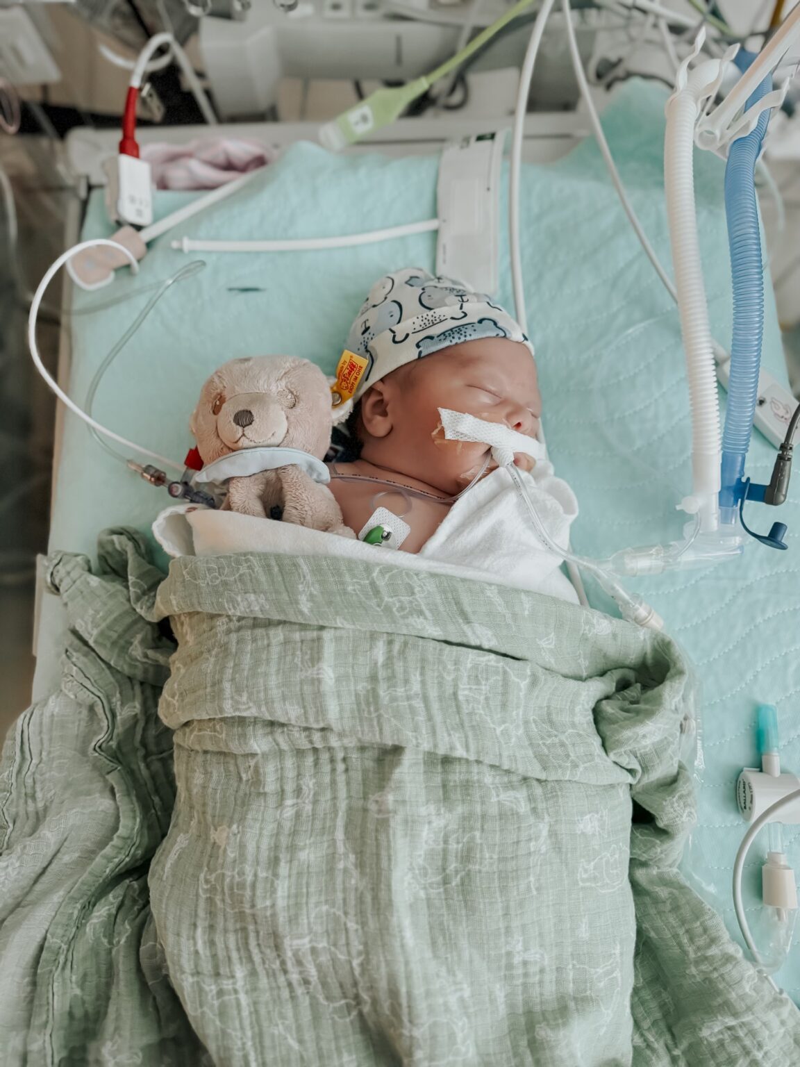 Dextro-Transposition of the Great Arteries: Nico’s Story | Patient Stories